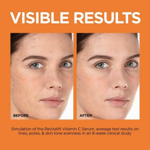 L'Oréal Paris Revitalift Clinical 12% Pure Vitamin C Serum Veido ...